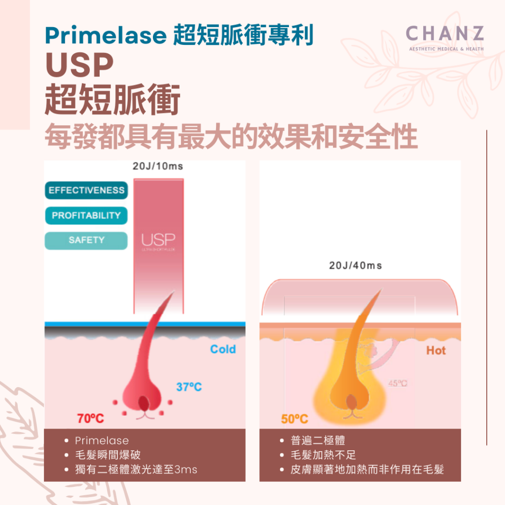 No.1 永久激光脫毛療程 - Chanz